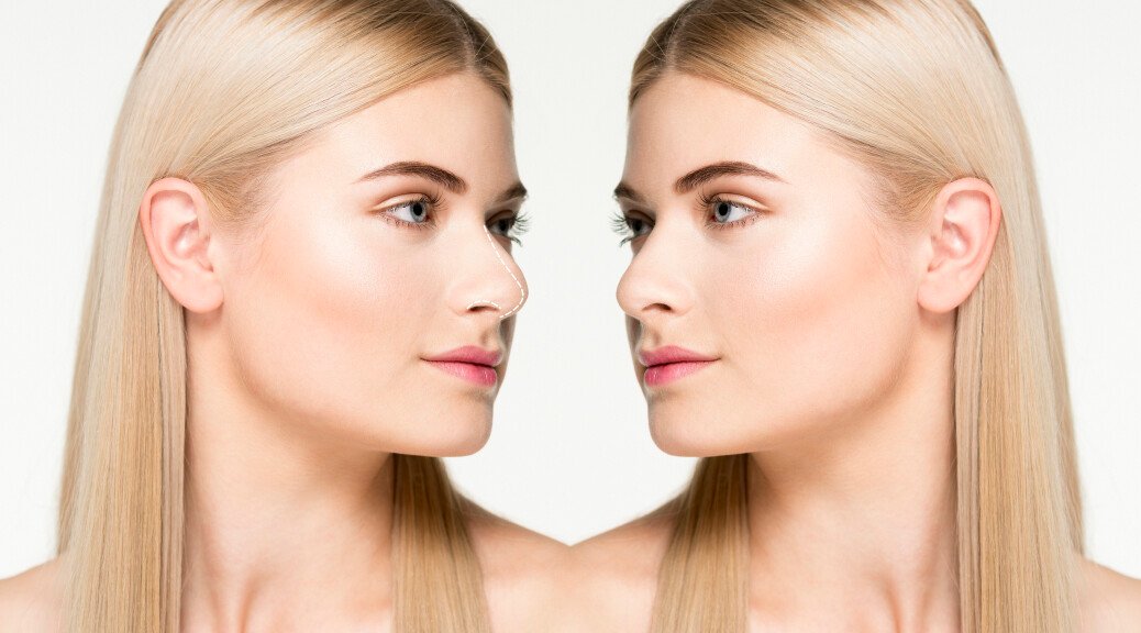 good plastic surgery before and after surgery